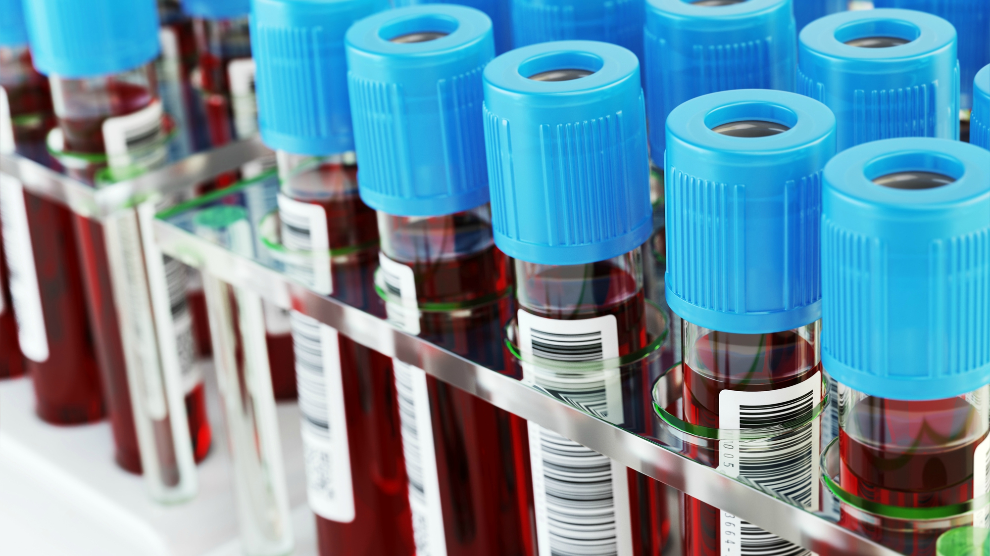 STDs on the rise in Bexar County, Metro Health says | khou.com