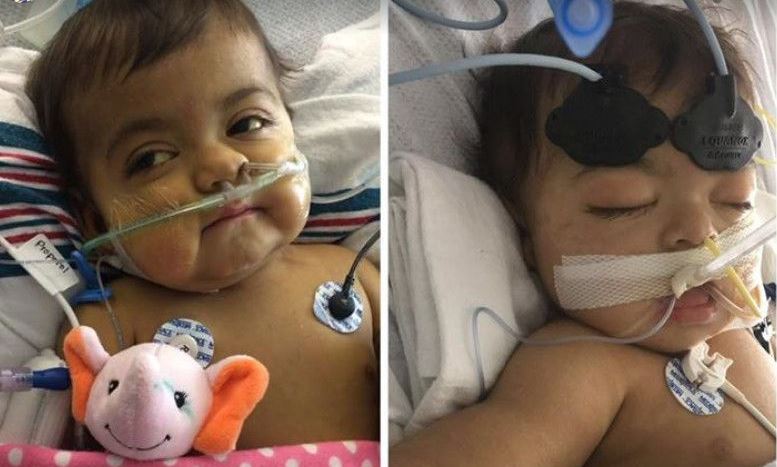 S.A. baby with rare disease shocks doctors, makes miraculous recovery ...